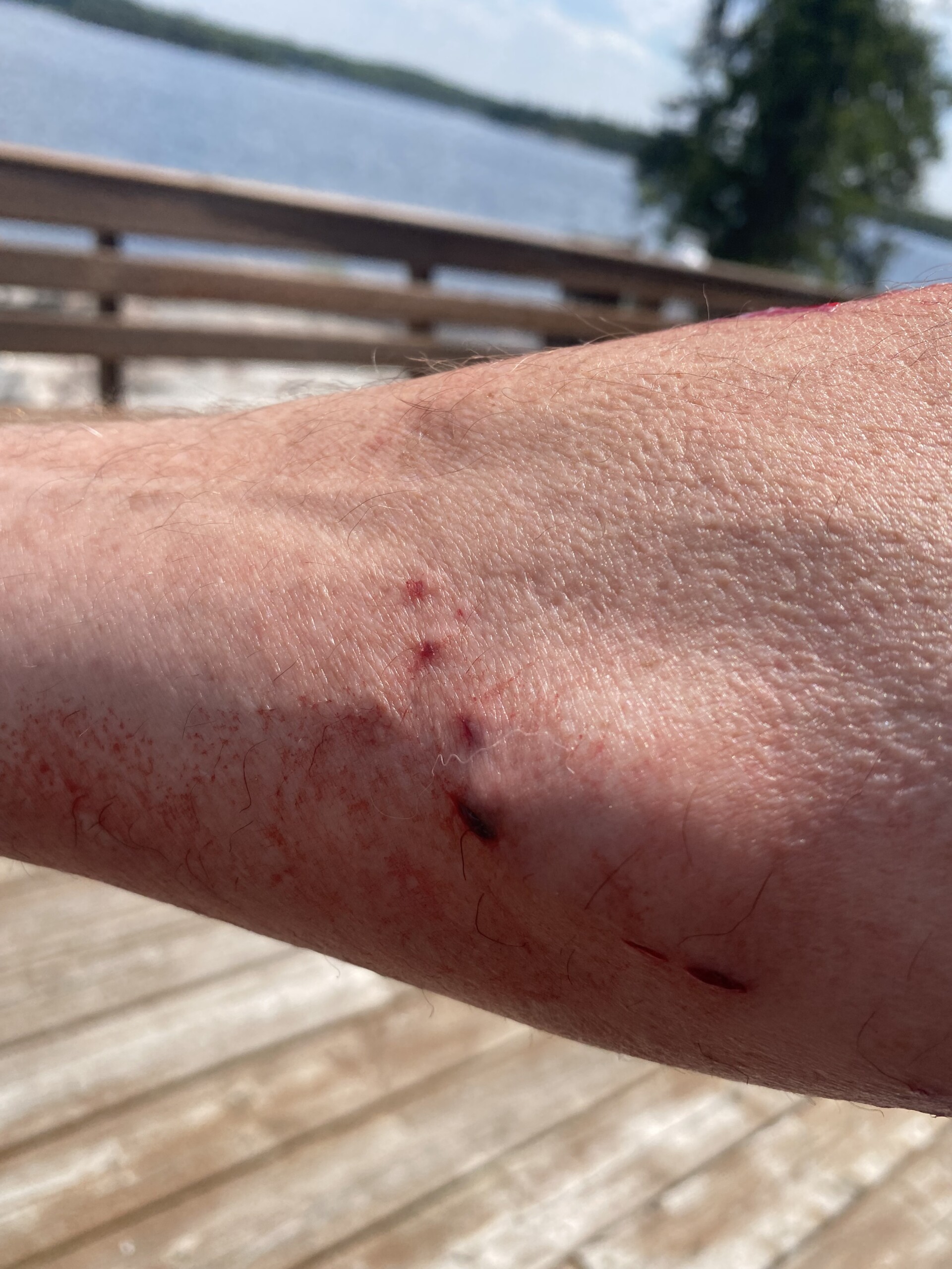 Ontario Man Attacked by Northern Pike – Fish'n Canada